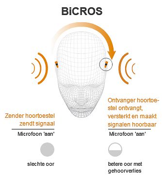 BICROS Producten Oorhuis